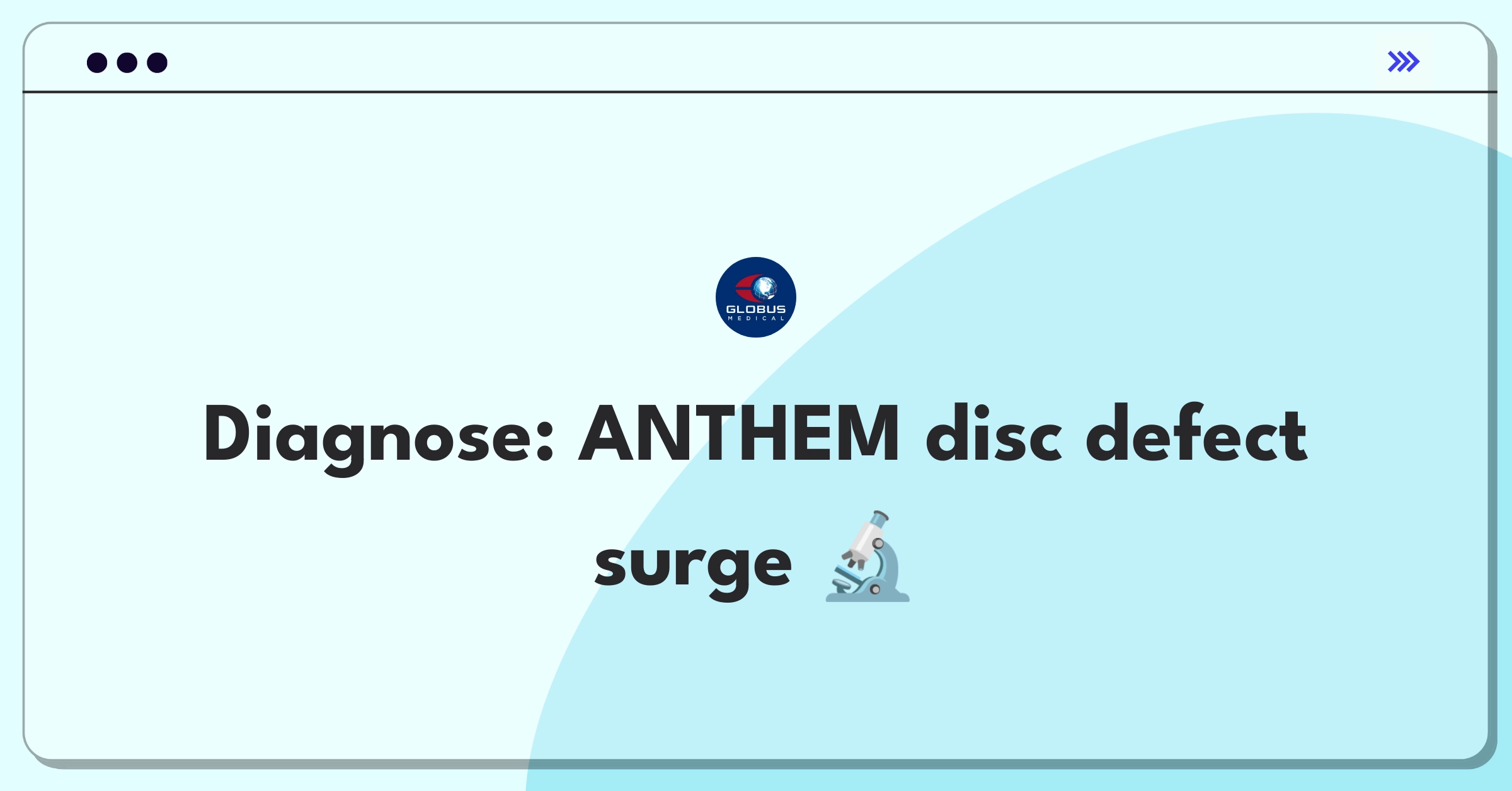 Globus Medical Defect Spike | Product RCA Interview - NextSprints